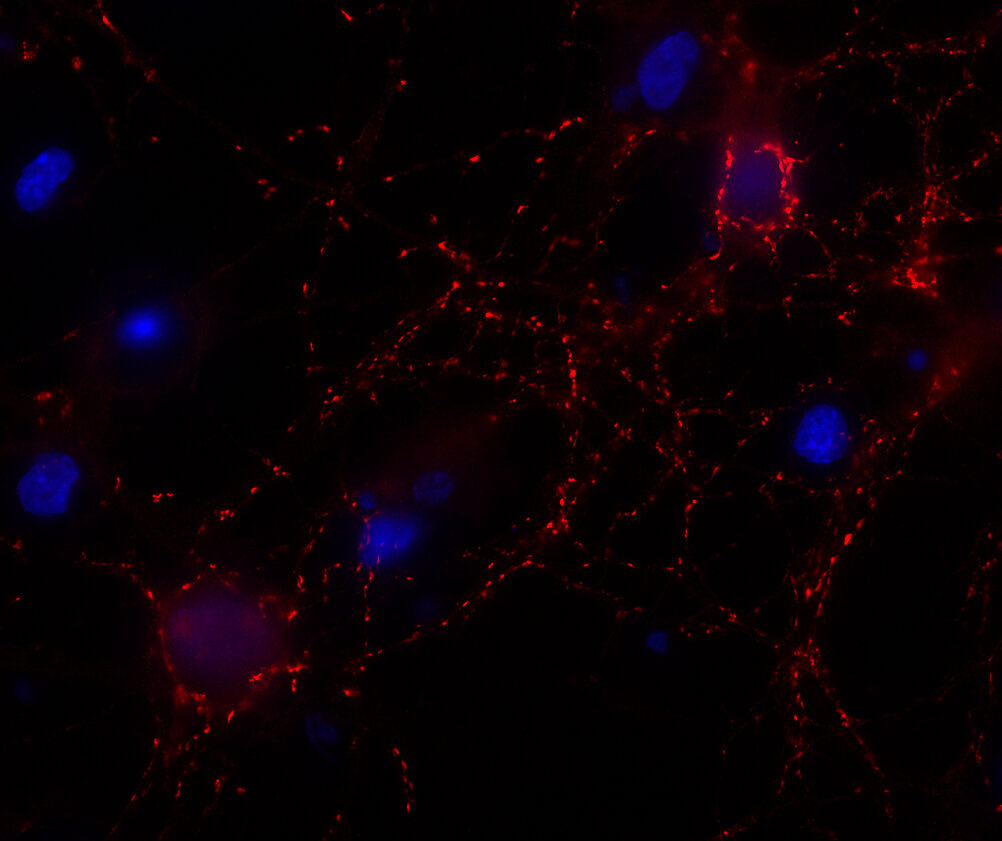 Synaptic Systems - VGAT
