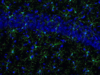 Synaptic Systems - IBA1